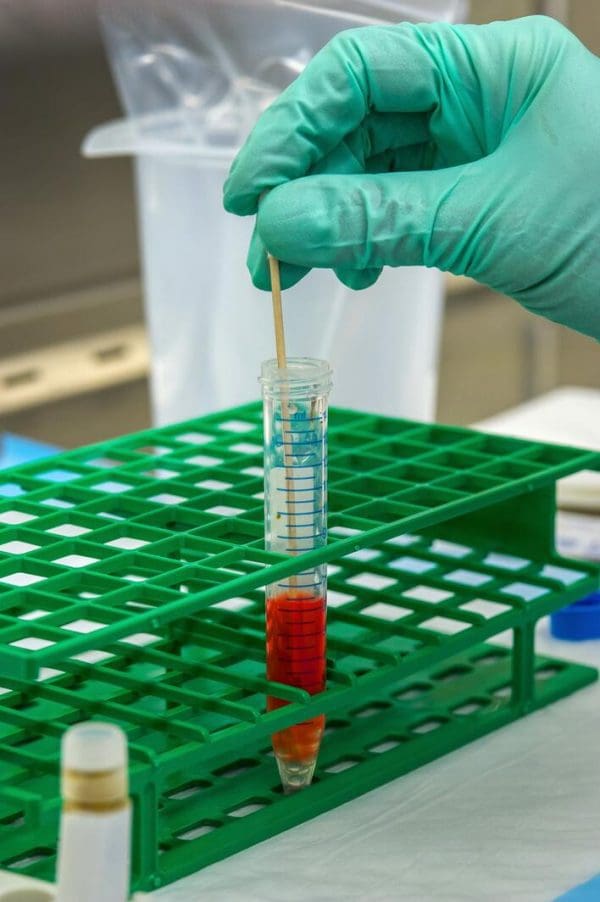 Candida Test UK | IBS Clinics
