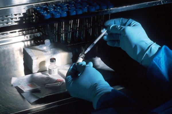 Candida Test UK | IBS Clinics