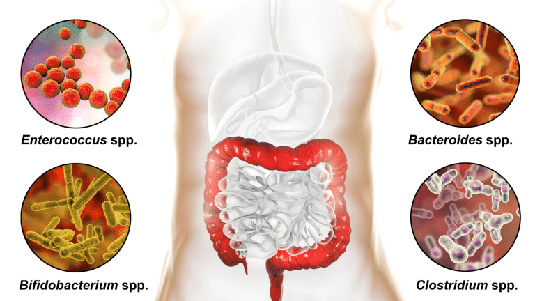 SIBO NHS - IBS Clinics