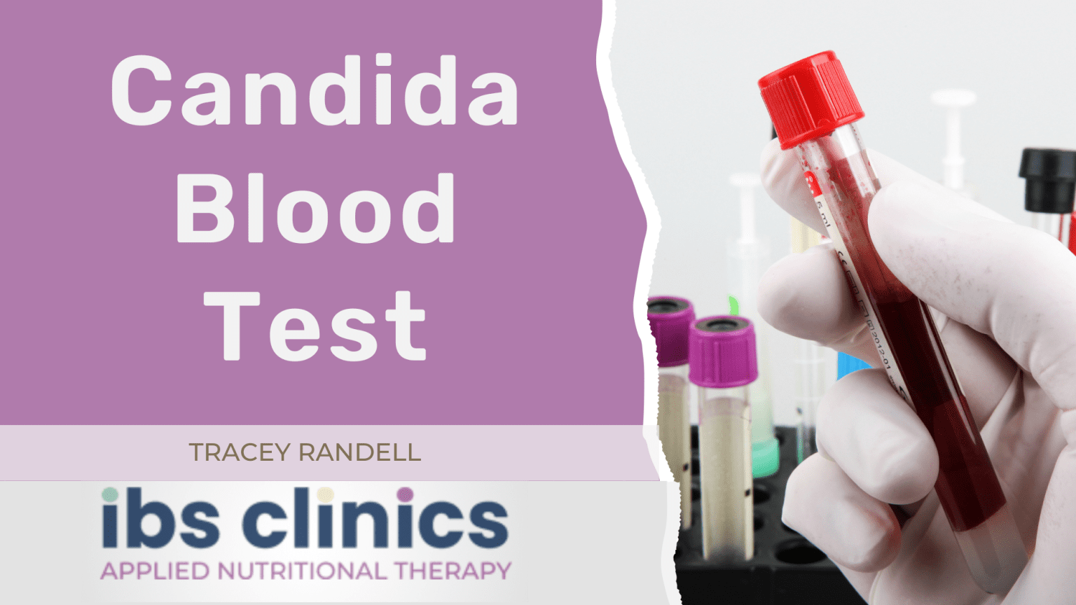 Candida Blood Test - IBS Clinics