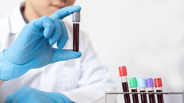 How to Test for Candida - IBS Clinics