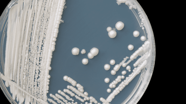 How to Test for Candida - IBS Clinics