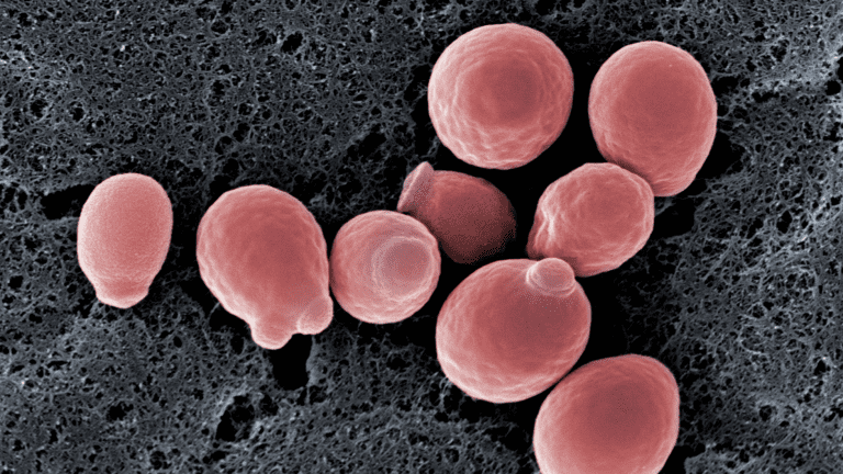 How to Test for Candida - IBS Clinics
