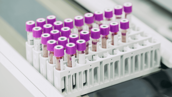 How to Test for Candida Overgrowth in Gut - IBS Clinics